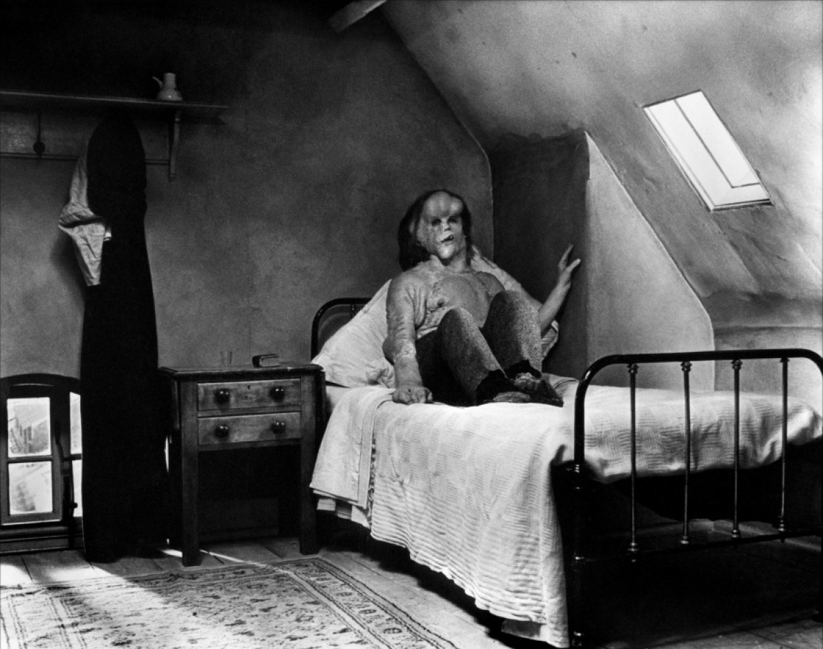 The Man They Called The Elephant Man...