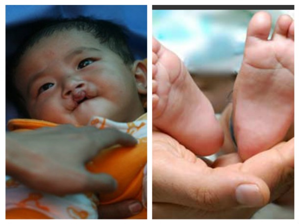 72-Year-Old Indian Woman Gives Birth To Her First Baby!