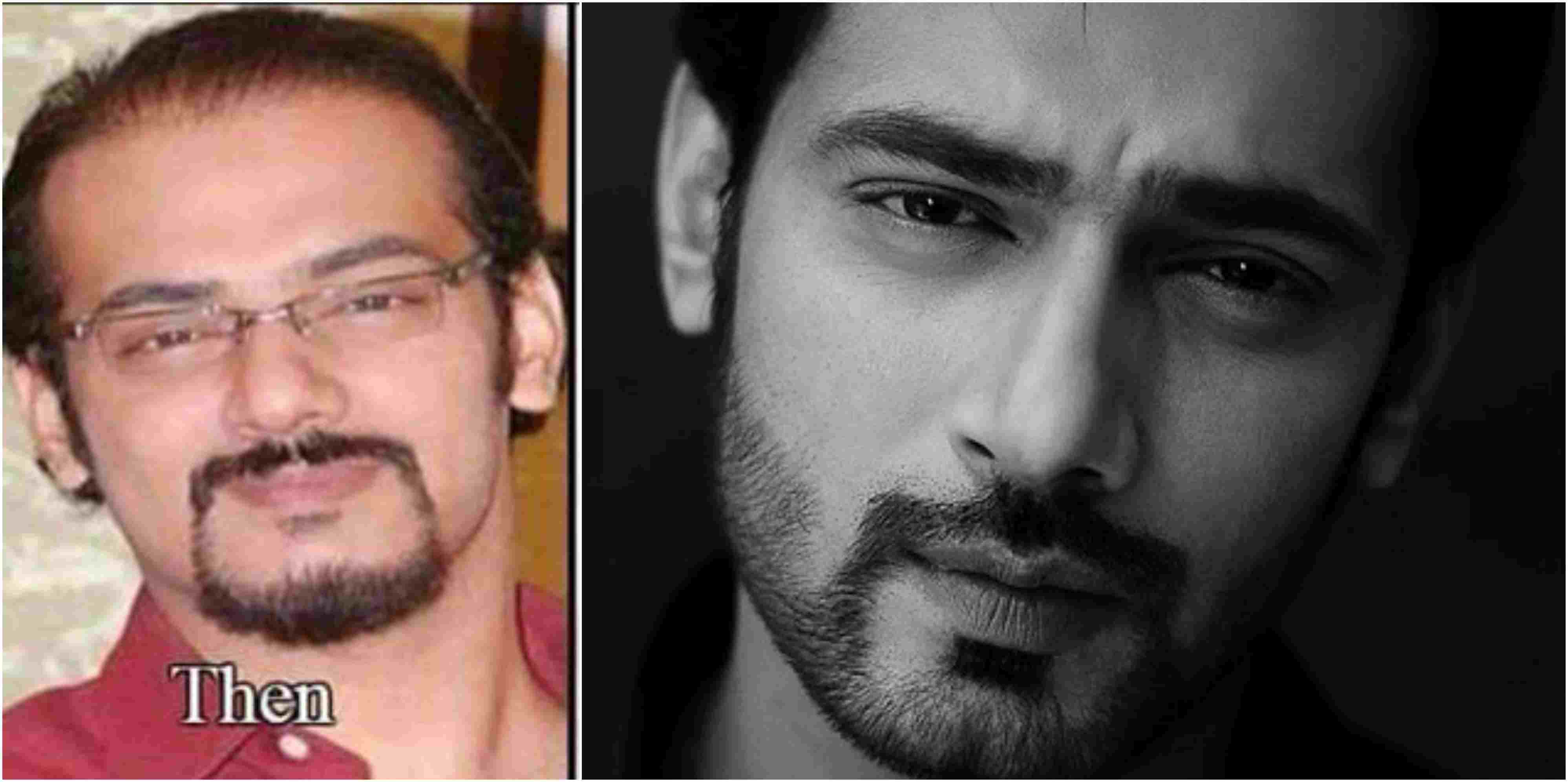 Zahid Ahmed's Struggle In Life Is Inspiring Everyone!