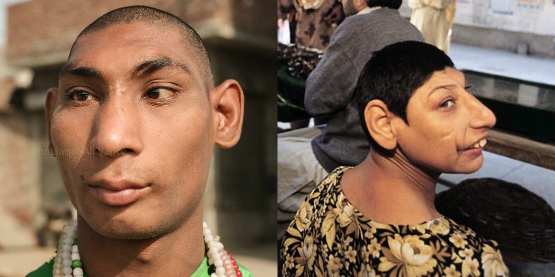 Shah Daula's 'Choohay' And The Violation Of Human Rights In Pakistan's ...