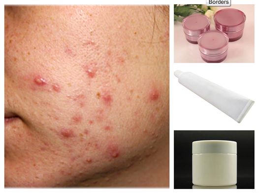 6 Horrible Things Fairness Creams Are Doing To Your Skin