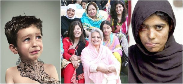Here's How Pakistan Is Countering And Helping Victims Of Acid Attacks