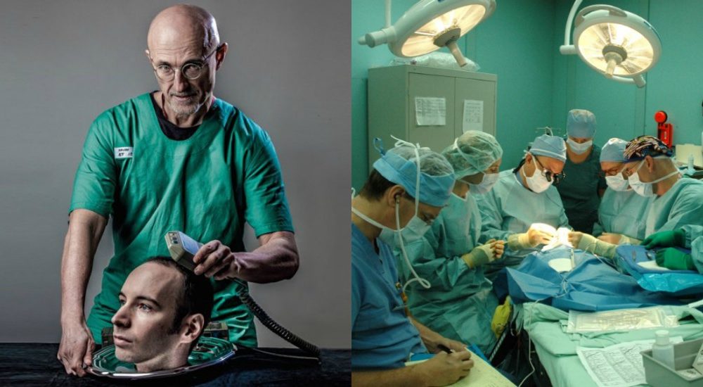 World's First Human Head Transplant May Give Mankind The Option To ... World's First Human Head Transplant May Give Mankind The Option To ...