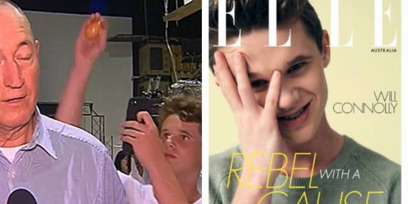 Egg Boy The Online Hero Becomes The Face Of Elle Magazine October Issue ...
