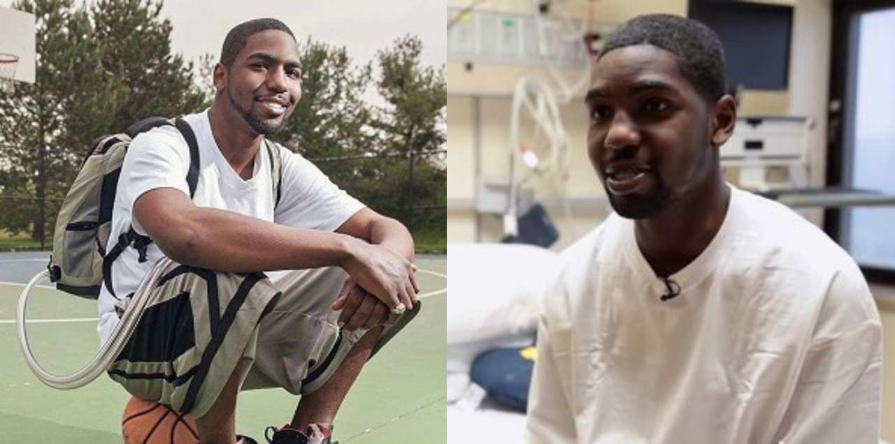 This Man Lived 555 Days Without A 'Real' Heart & You Will Be Shocked To ...